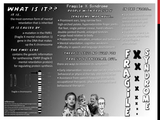Fragile X Syndrome | PPTX