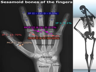 SESAMOID BONES | PPT