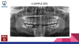 Fyp 2 presentation | PPT