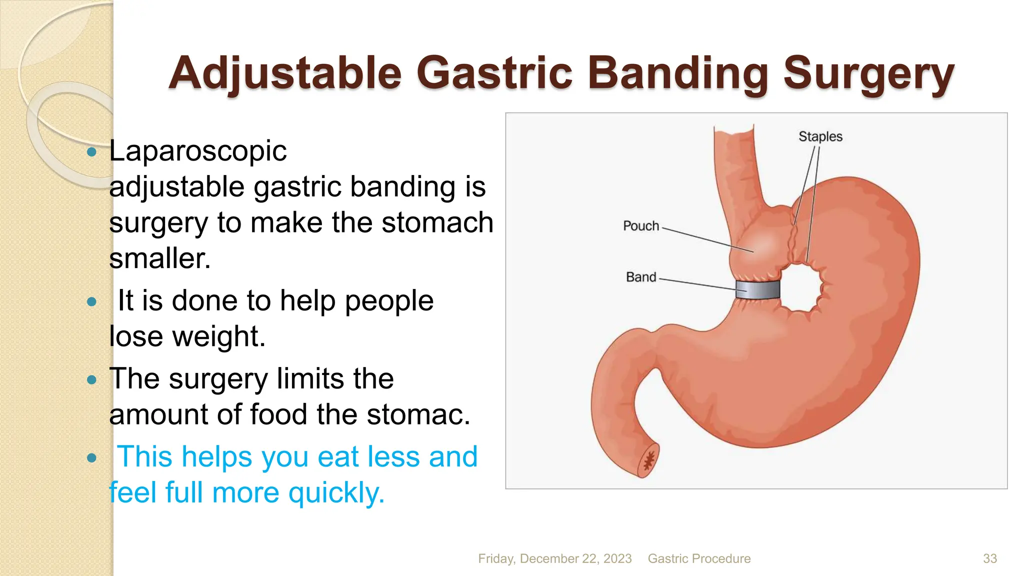 What is Gastrointestinal surgery slideshare | PPTX