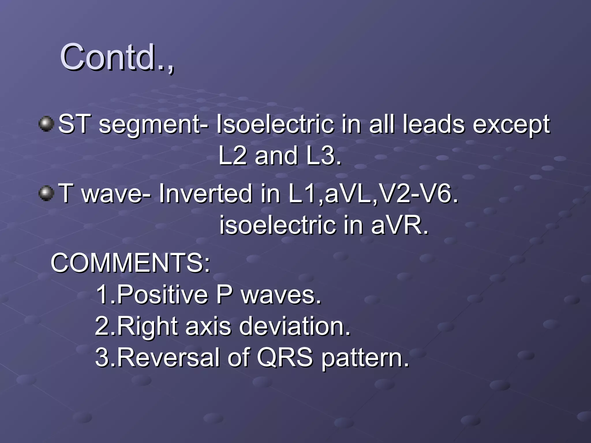 ECG: Dextrocardia | PPT