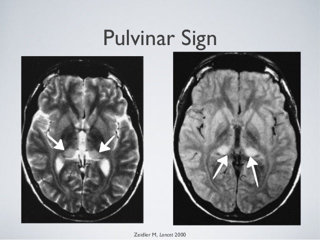 Georgetown University Hospital Dept of Medicine Grand Rounds