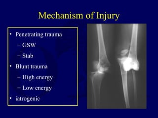 vascular injury | PPT