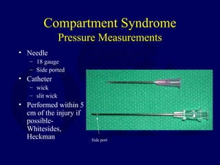 G04 compartment syndrome | PPT
