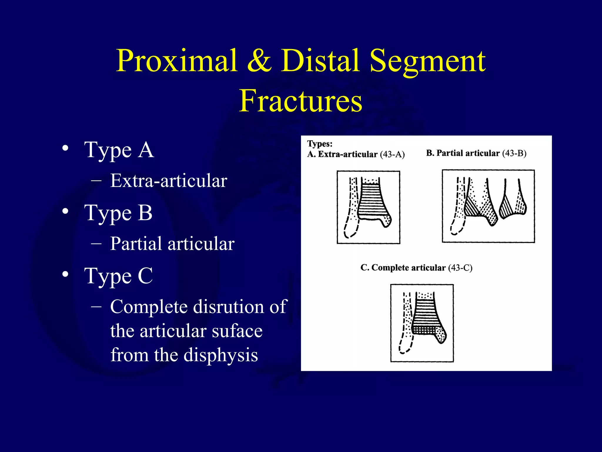 G06 fracture classification | PPT