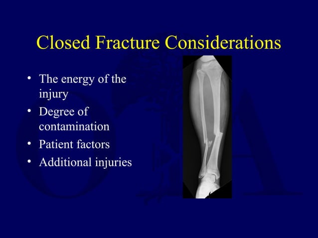 G06 fracture classification | PPT