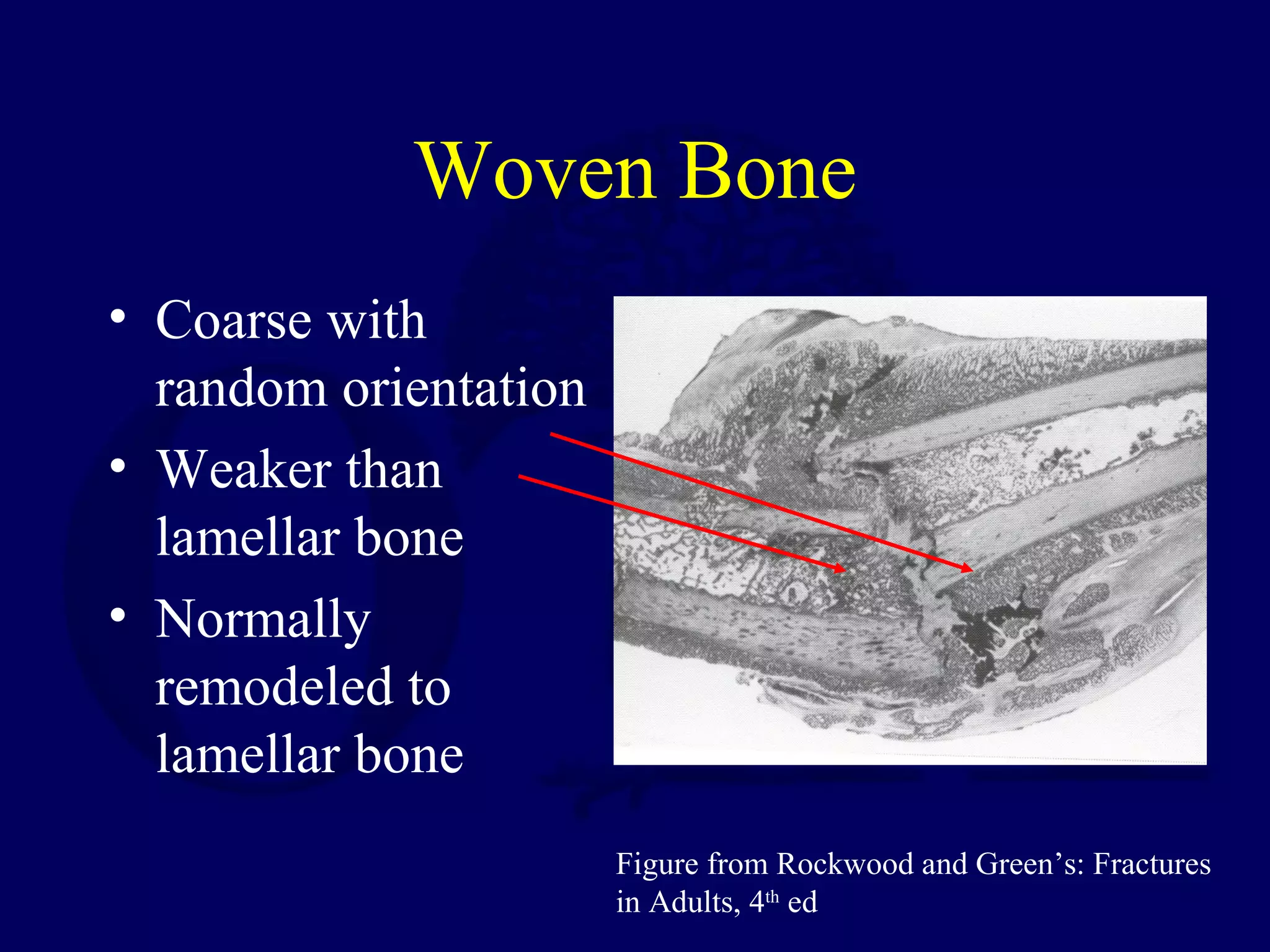 G07 biology of bone repair | PPT