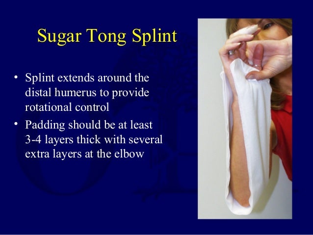 G09 crc, traction, casts