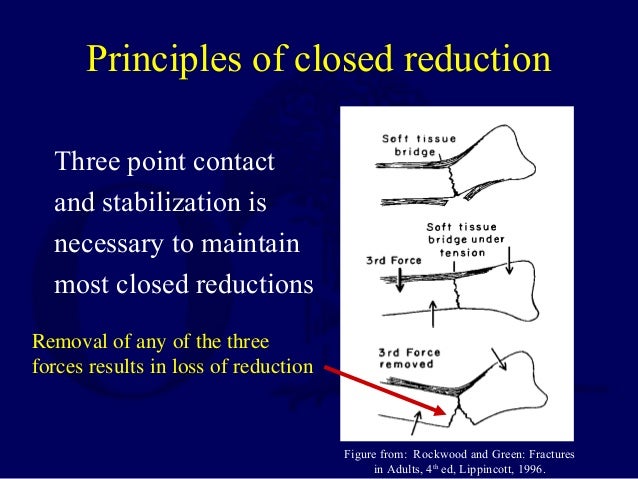 G09 crc, traction, casts