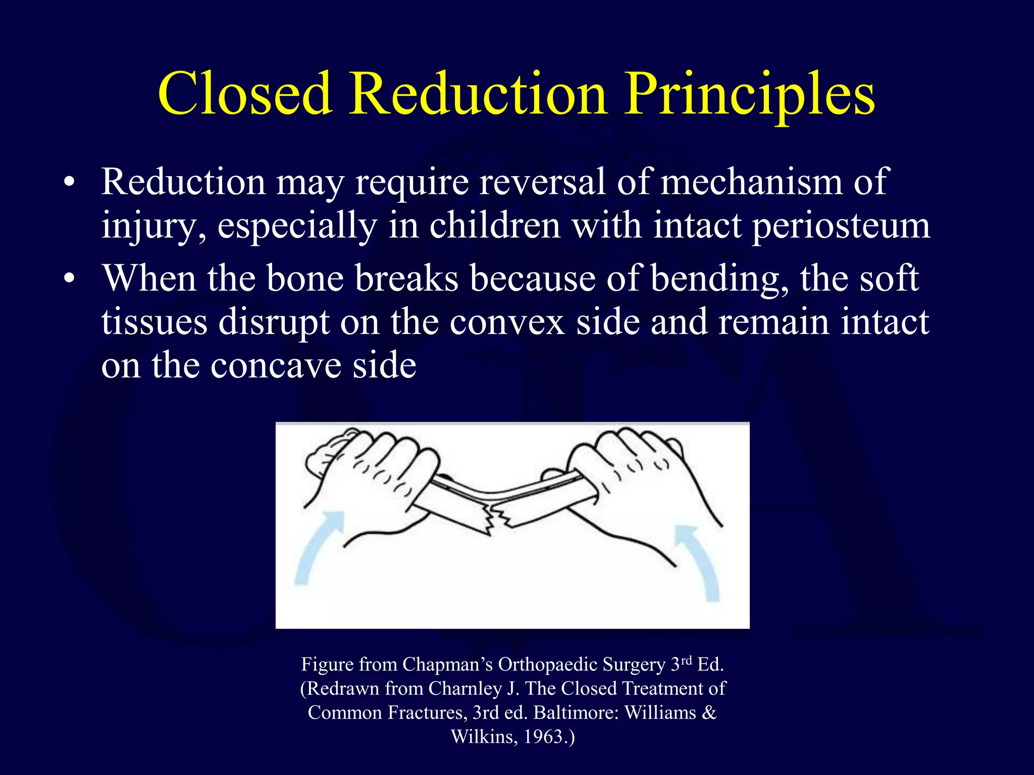 G09_CRC_Traction_Casts-JTG-rev-2-4-10.ppt