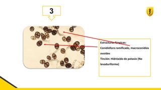G1.5_Practicas Fungicas_Indentificación de Partes y tipos.pptx