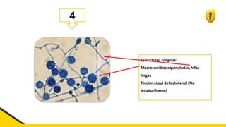 G1.5_Practicas Fungicas_Indentificación de Partes y tipos.pptx