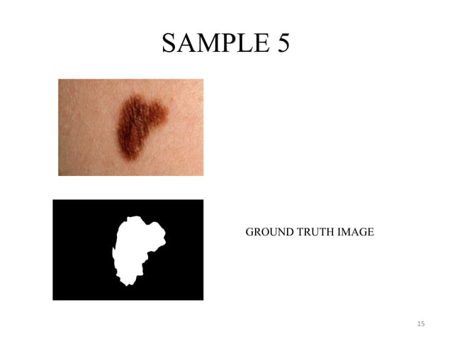 Segmentation Results Through Fcm Clustering With Matlab Program Ppt