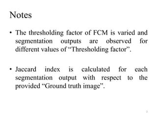 Segmentation Results through FCM clustering with MATLAB program | PPTX