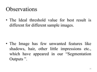 Segmentation Results through FCM clustering with MATLAB program | PPTX