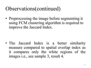Segmentation Results through FCM clustering with MATLAB program | PPTX
