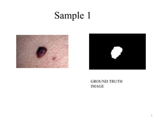 Segmentation Results through FCM clustering with MATLAB program | PPTX