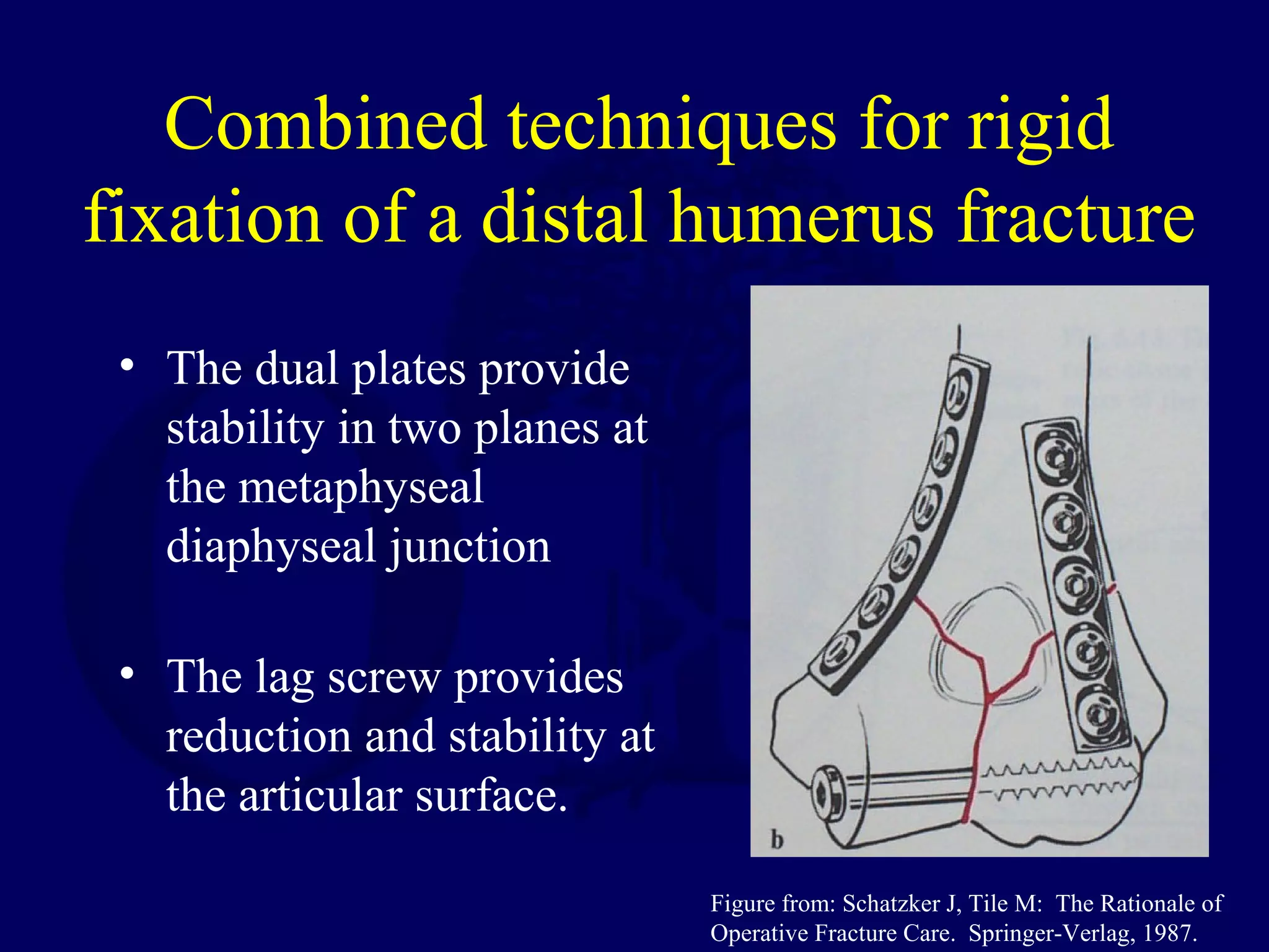 G10 internal fix principles | PPT | First Aid | Injuries