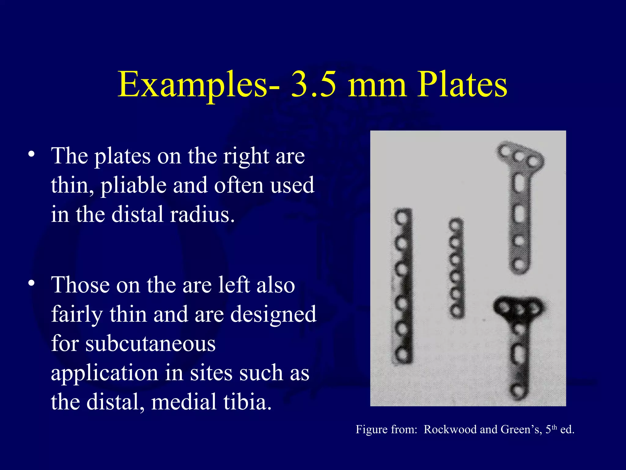 G10 internal fix principles | PPT | First Aid | Injuries