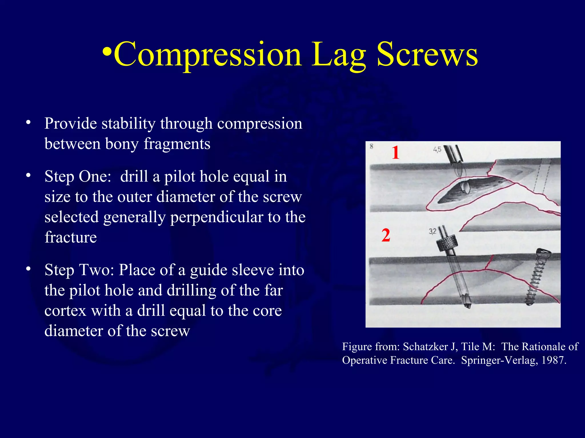 G10 internal fix principles | PPT | First Aid | Injuries