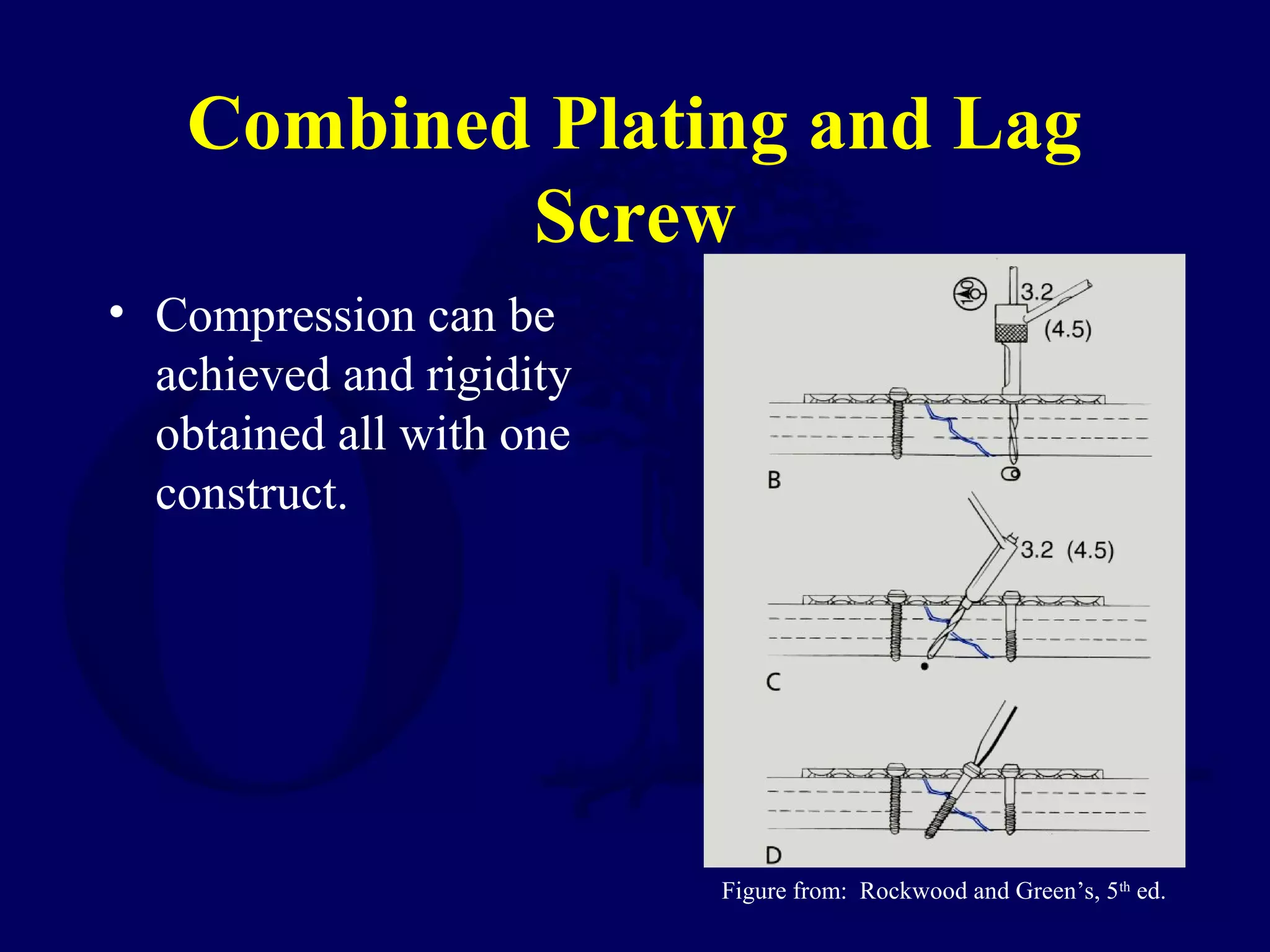 G10 internal fix principles | PPT | First Aid | Injuries