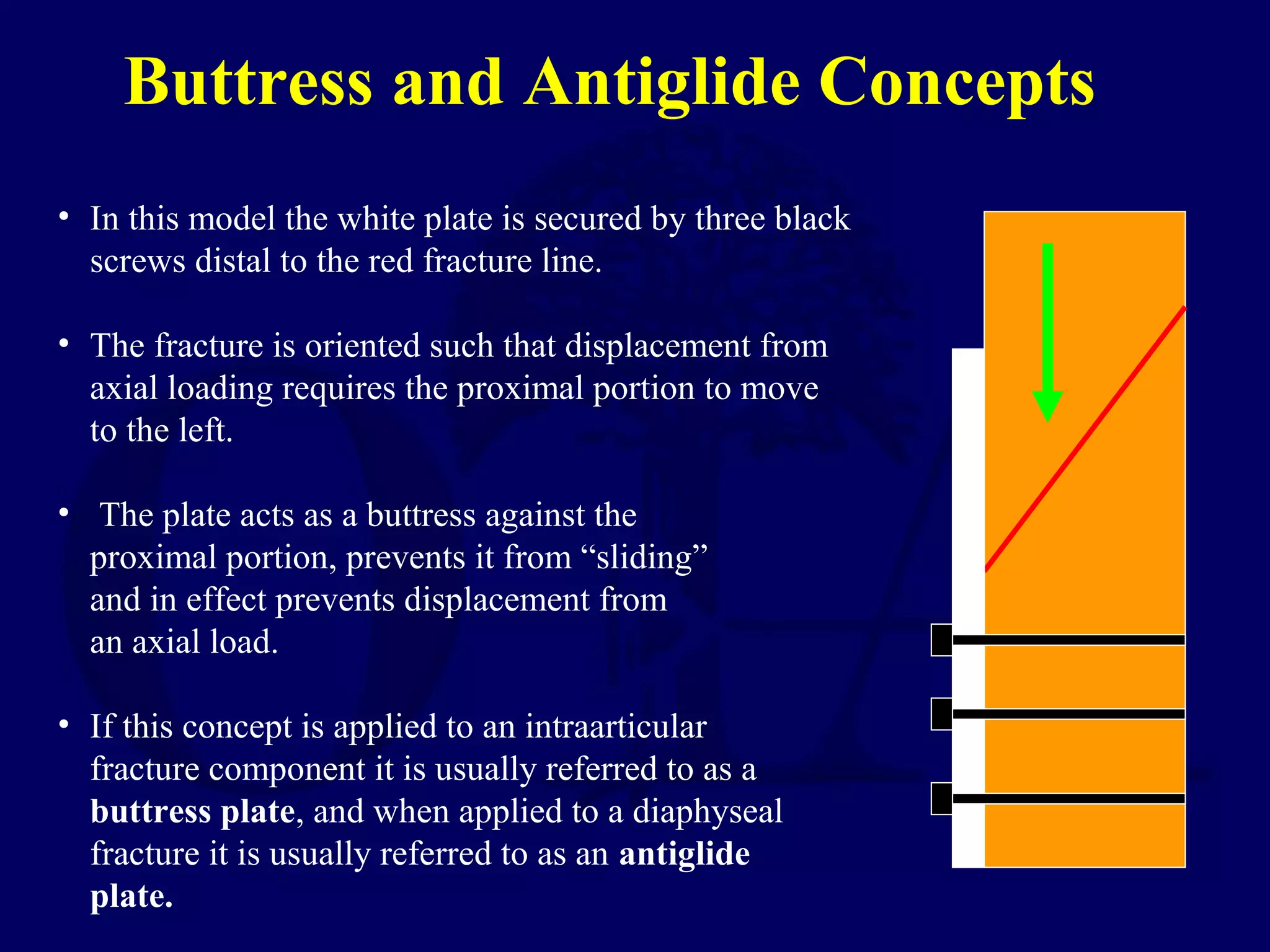 G10 internal fix principles | PPT | First Aid | Injuries