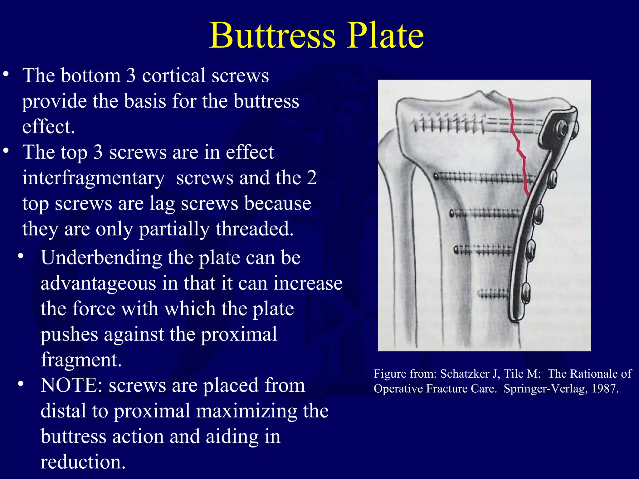 G10 internal fix principles | PPT