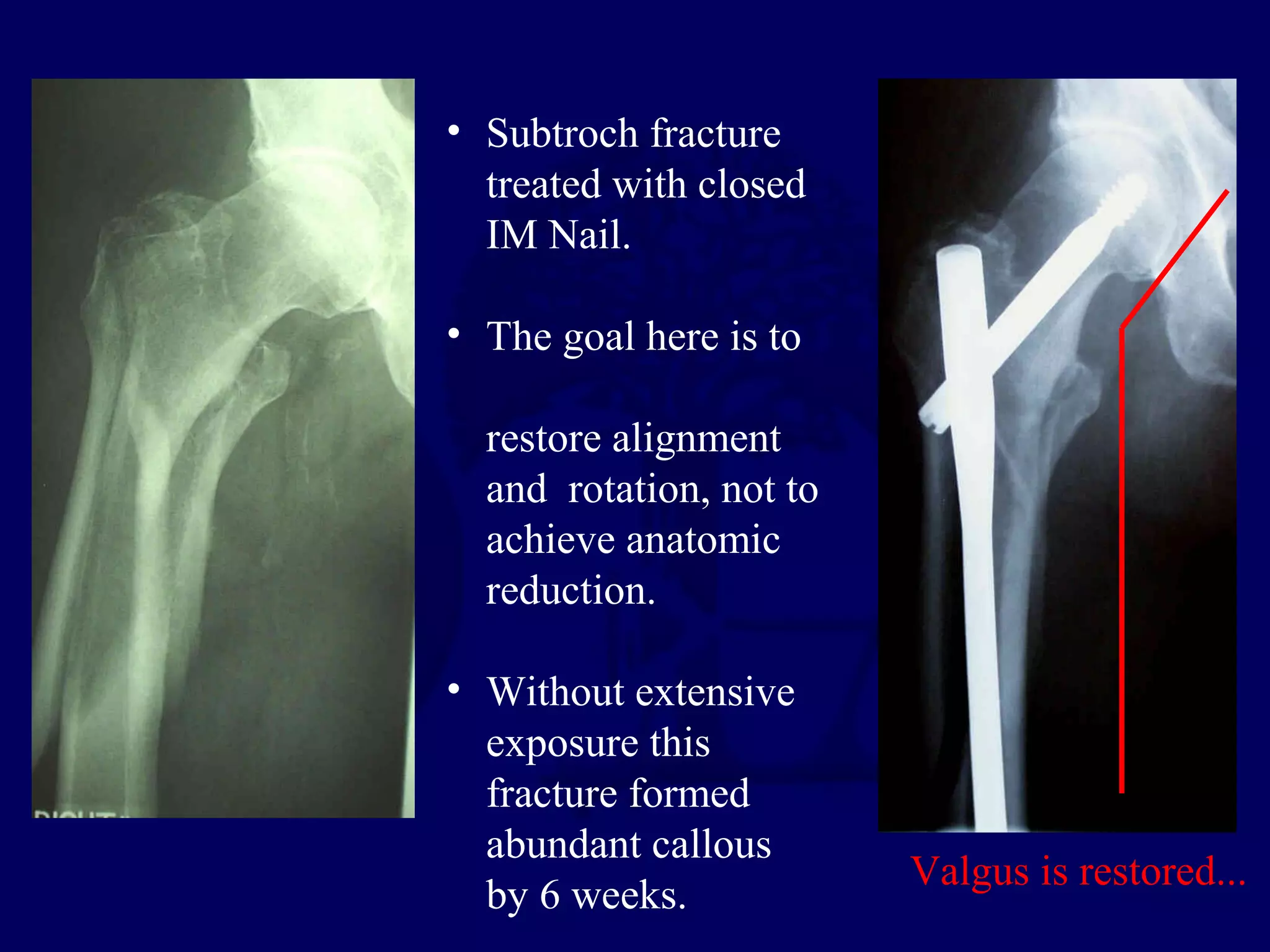G10 internal fix principles | PPT | First Aid | Injuries