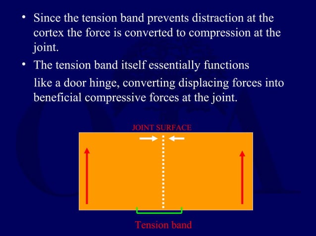 G10 internal fix principles | PPT | First Aid | Injuries
