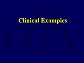 G10 internal fix principles | PPT