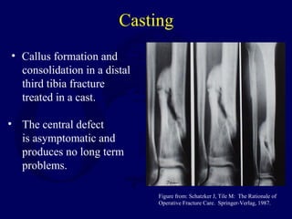 G10 internal fix principles | PPT | First Aid | Injuries