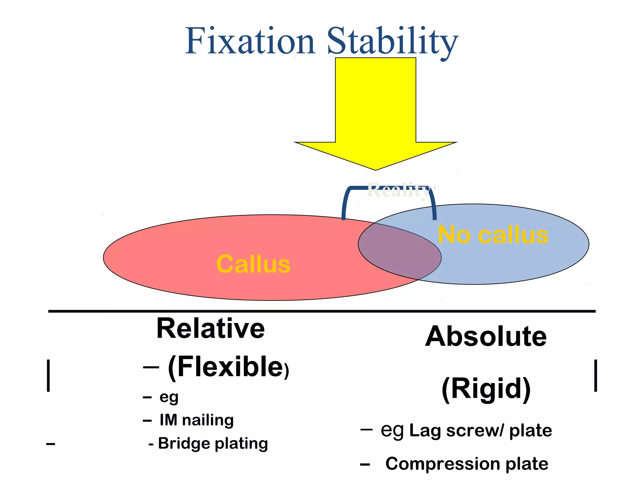 principles of internal fixation | PPT