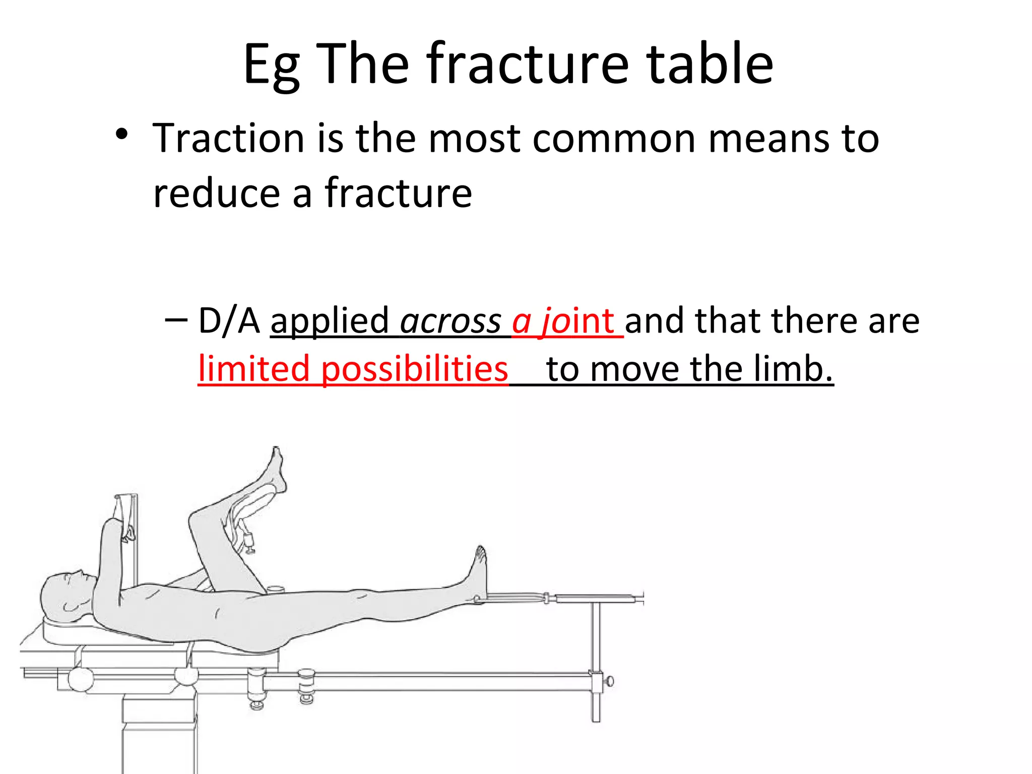 principles of internal fixation | PPT