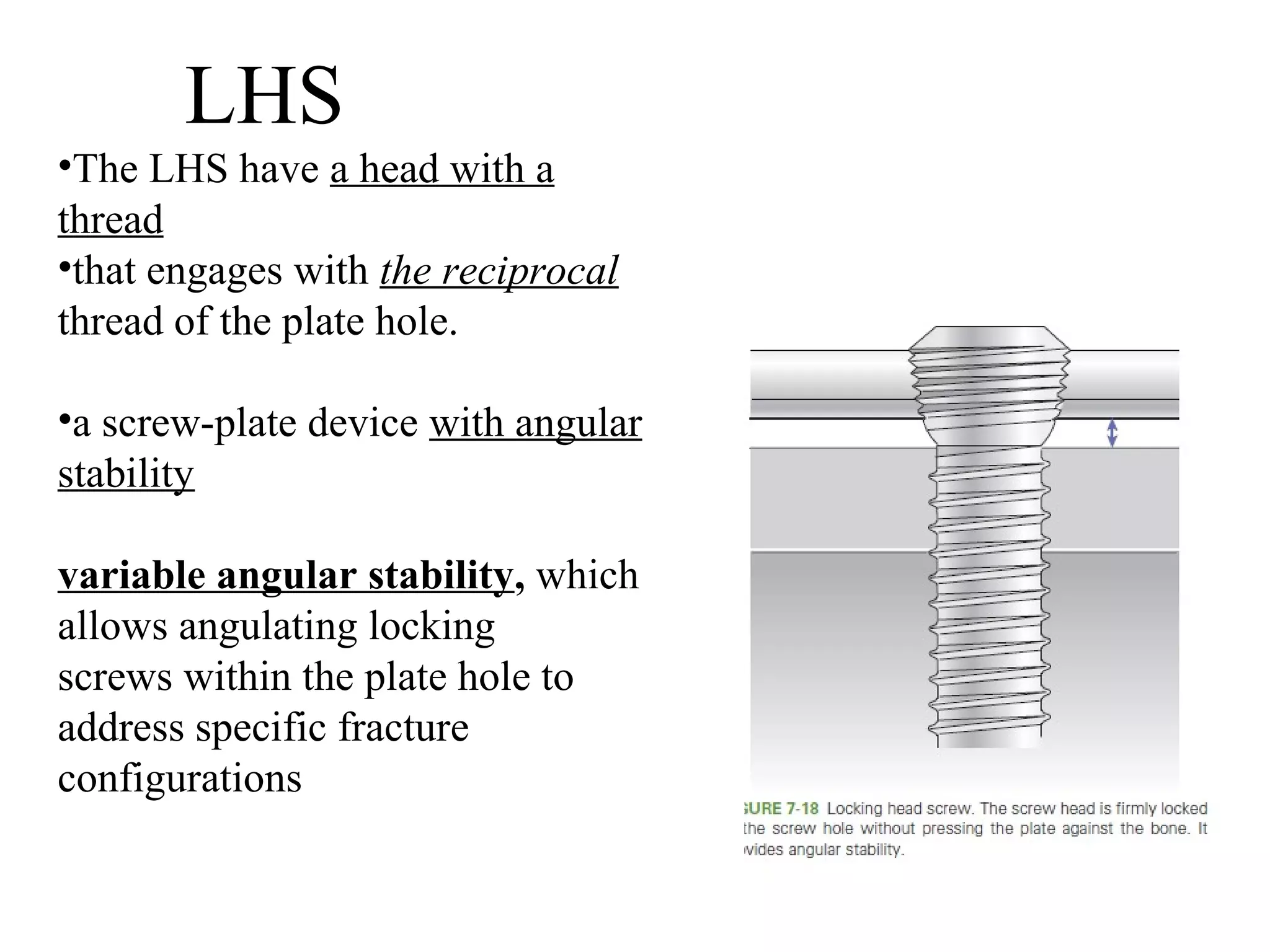 principles of internal fixation | PPT