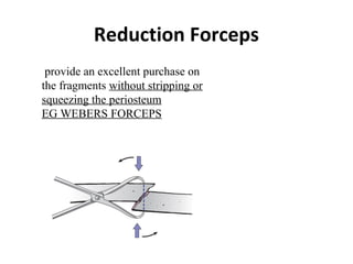 principles of internal fixation | PPT