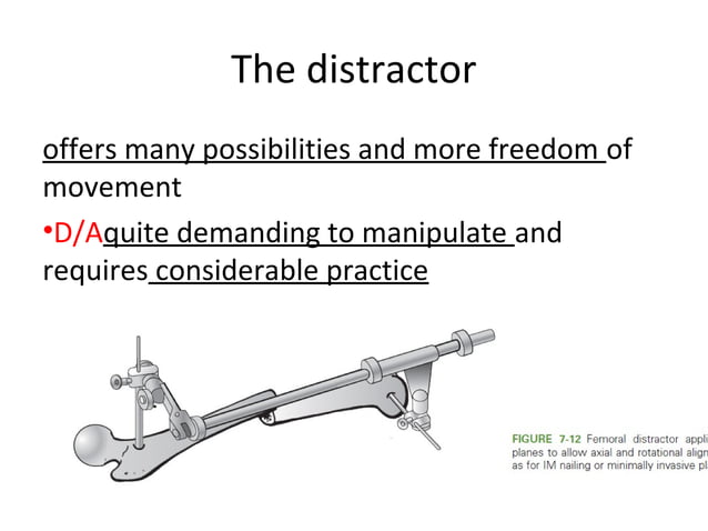principles of internal fixation | PPT