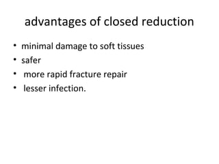 principles of internal fixation | PPT