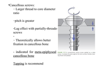 principles of internal fixation | PPT