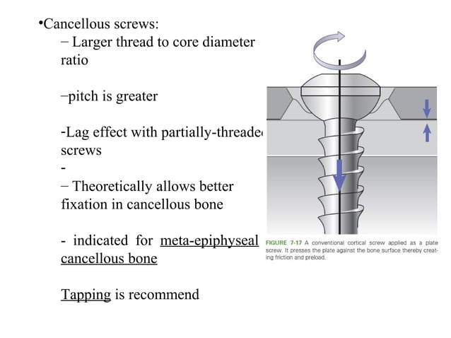 principles of internal fixation | PPT