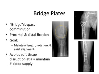 principles of internal fixation | PPT