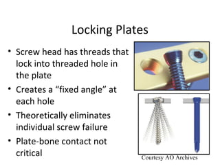 principles of internal fixation | PPT