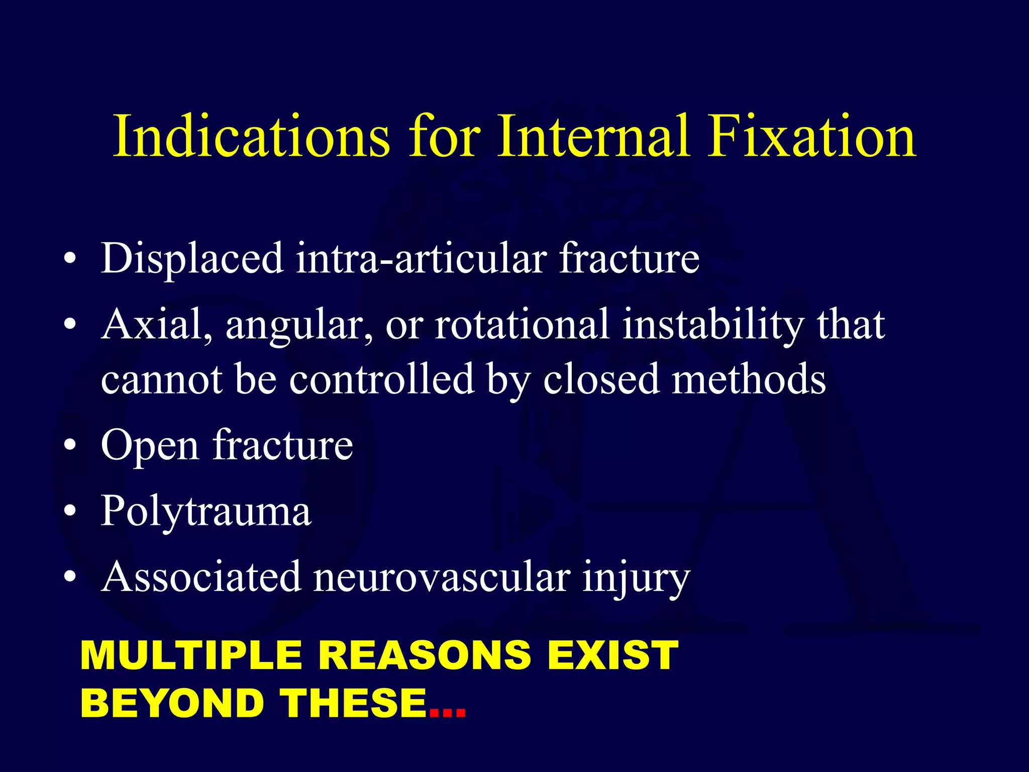 G10_Internal_Fix_Principles.ppt
