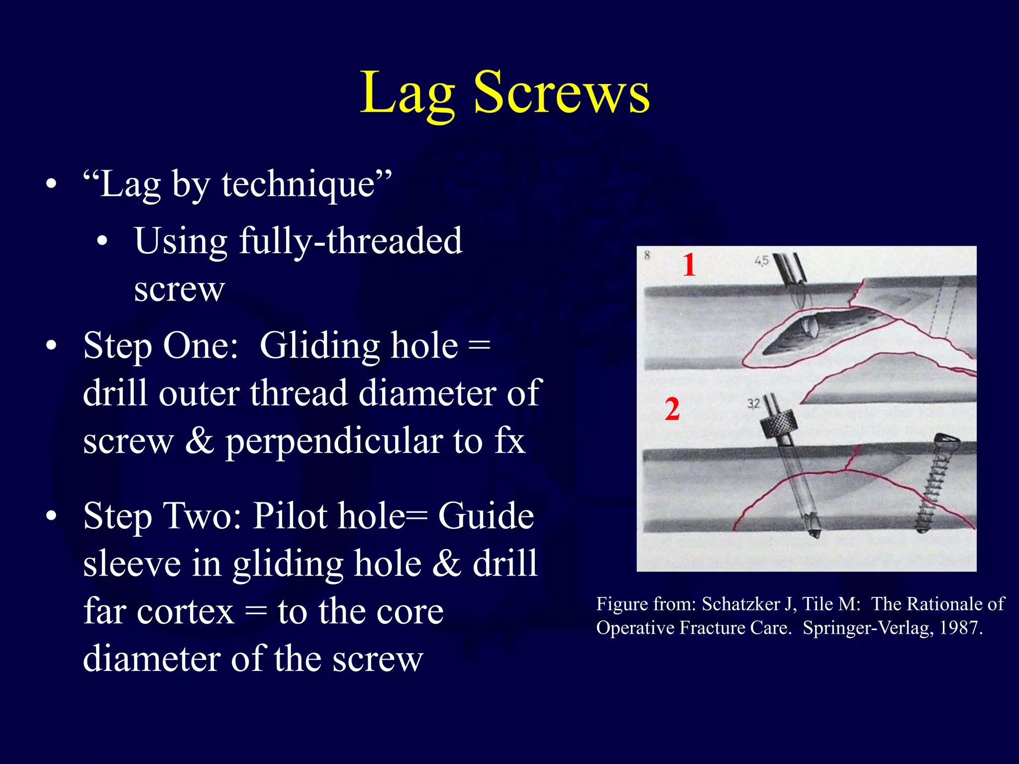 G10_Internal_Fix_Principles.ppt
