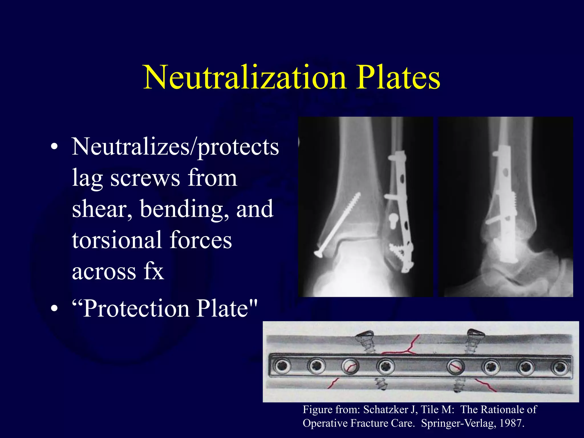 G10_Internal_Fix_Principles.ppt