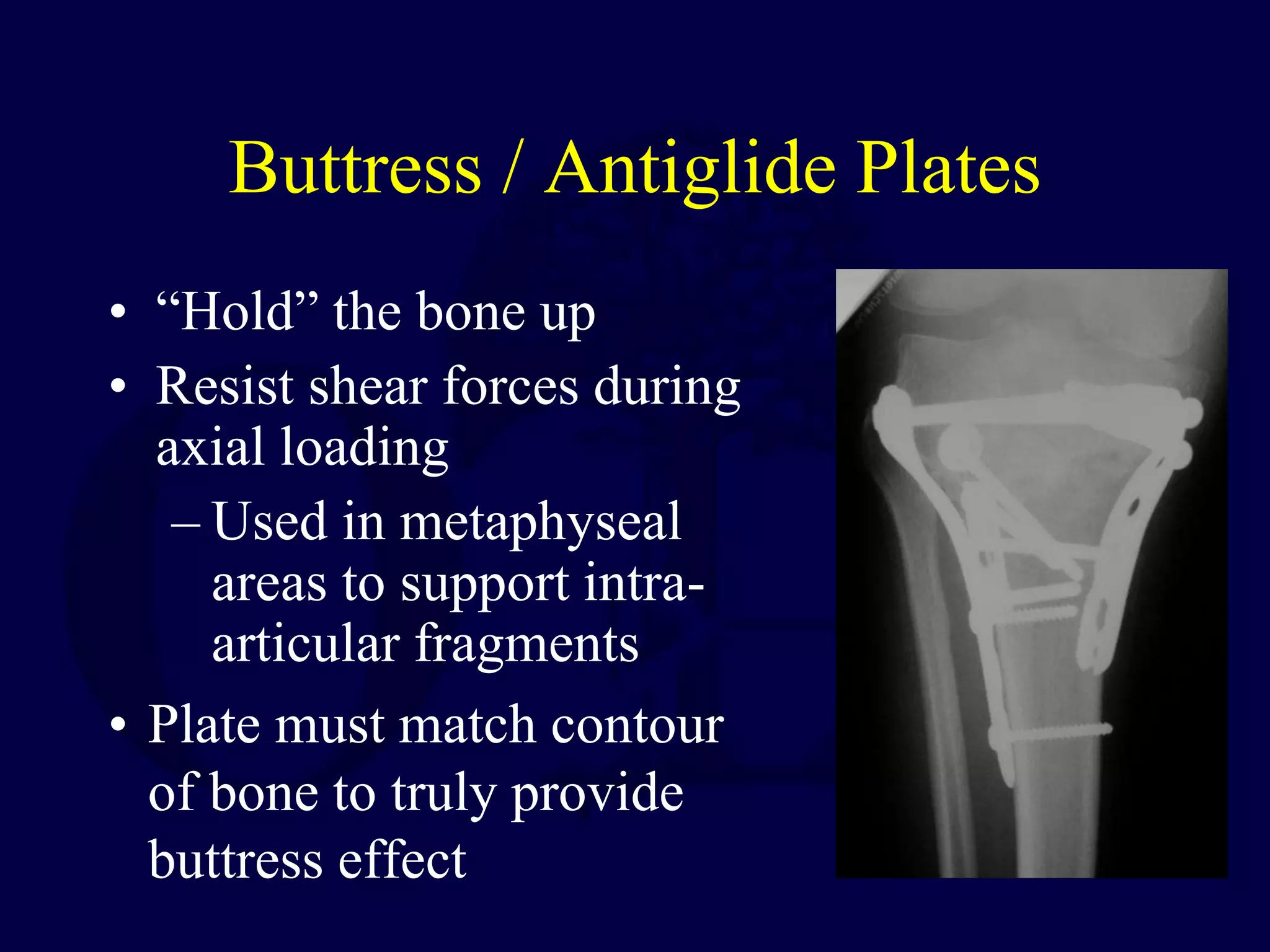 G10_Internal_Fix_Principles.ppt