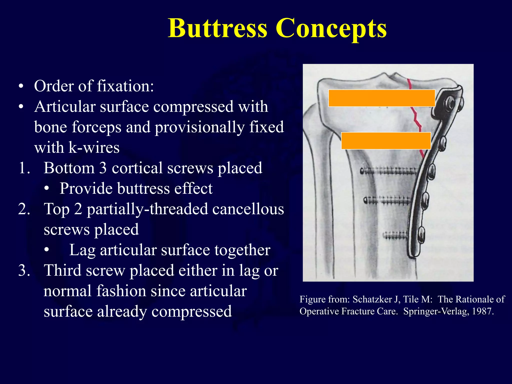 G10_Internal_Fix_Principles.ppt