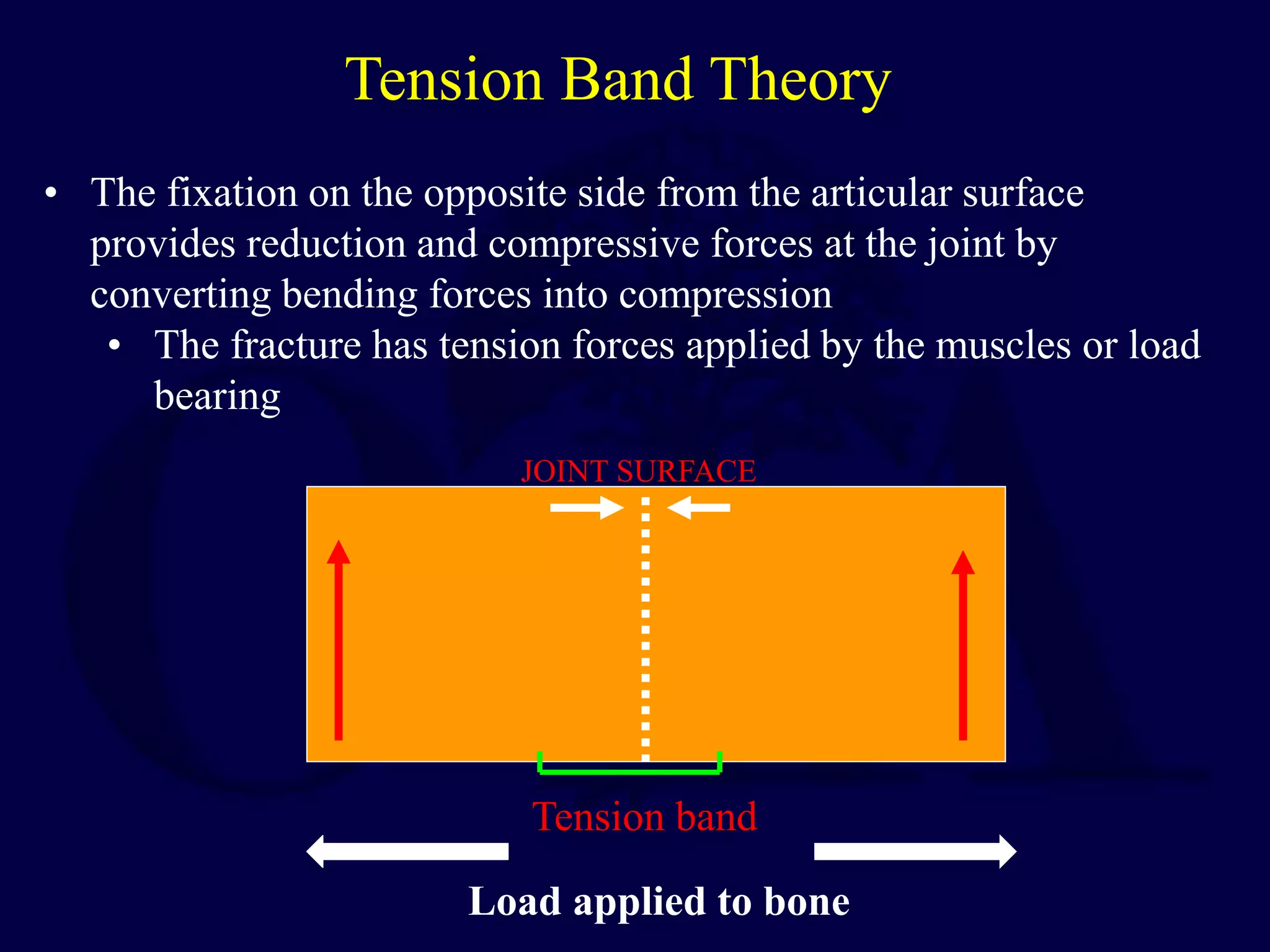 G10_Internal_Fix_Principles.ppt