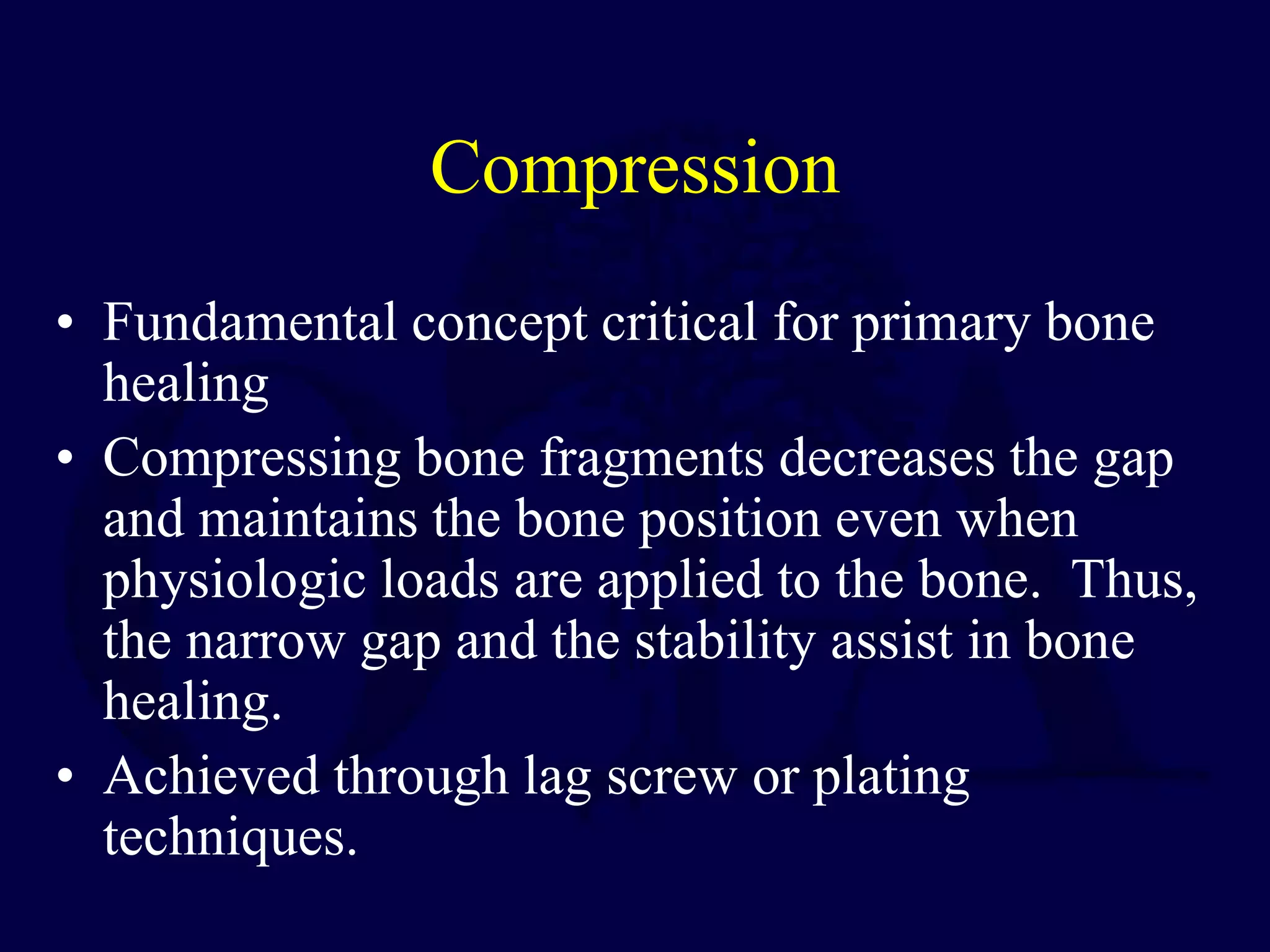 G10_Internal_Fix_Principles.ppt