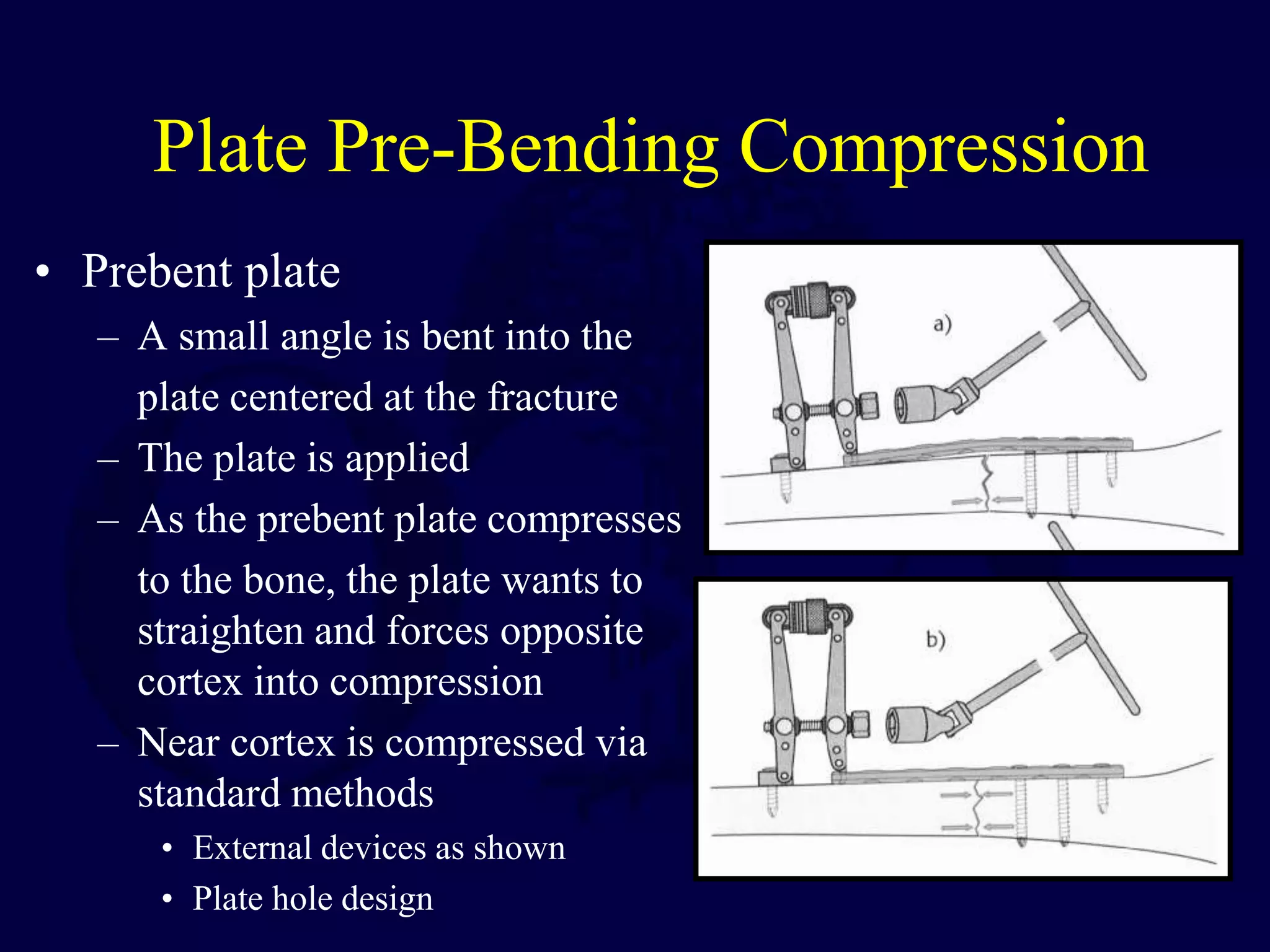 G10_Internal_Fix_Principles.ppt