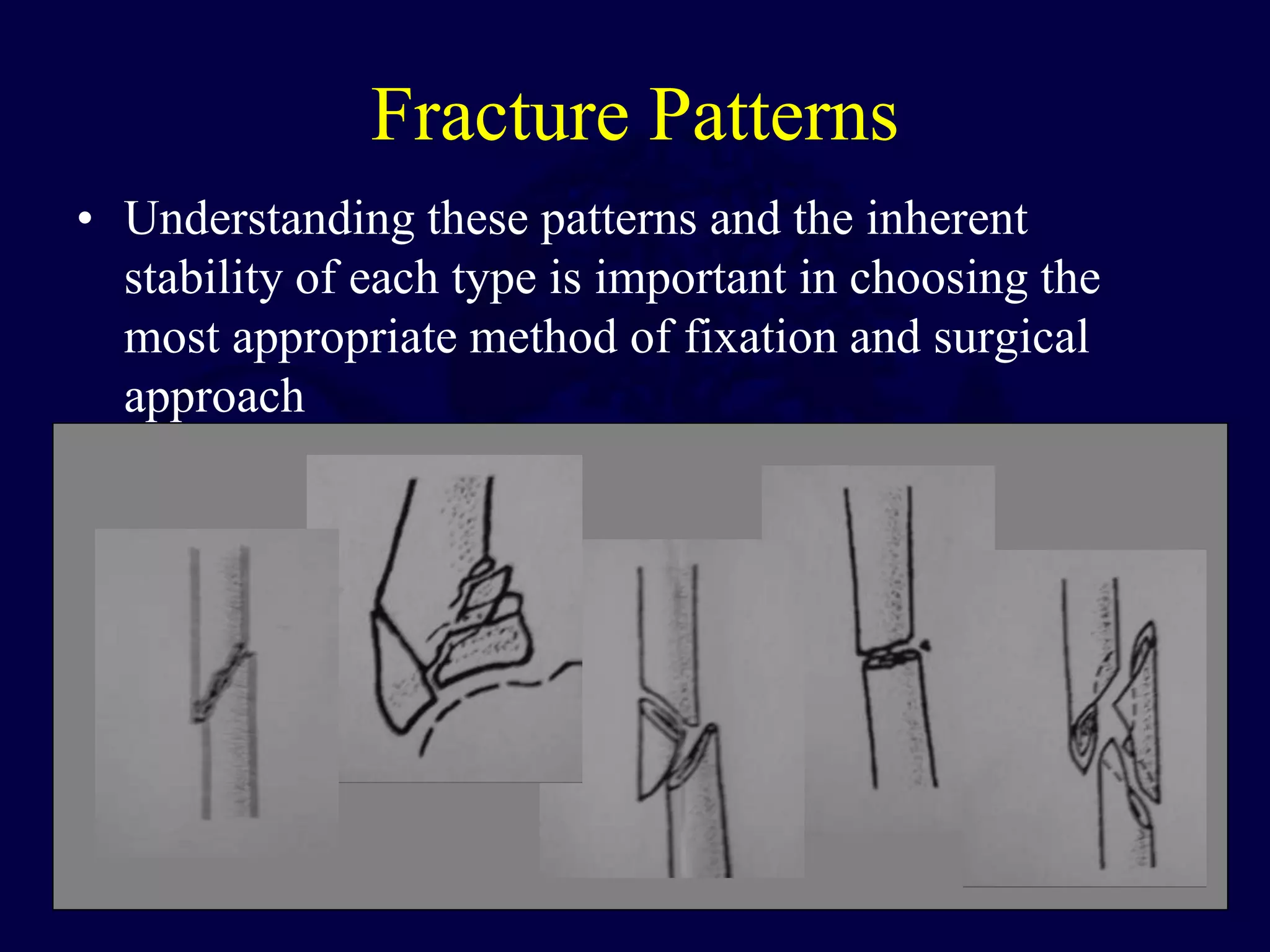 G10_Internal_Fix_Principles.ppt
